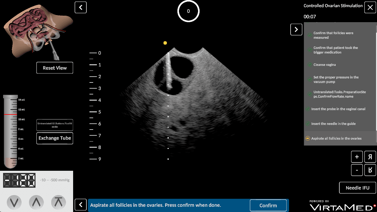 GynoS™ | Gynecology (OB/GYN) Training Simulator | VirtaMed