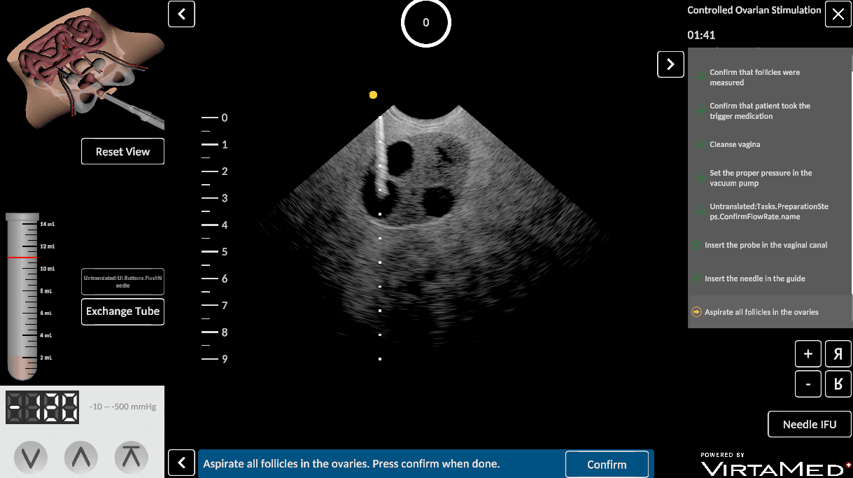 GynoS™ Ovum Pick-Up (OPU) | VirtaMed