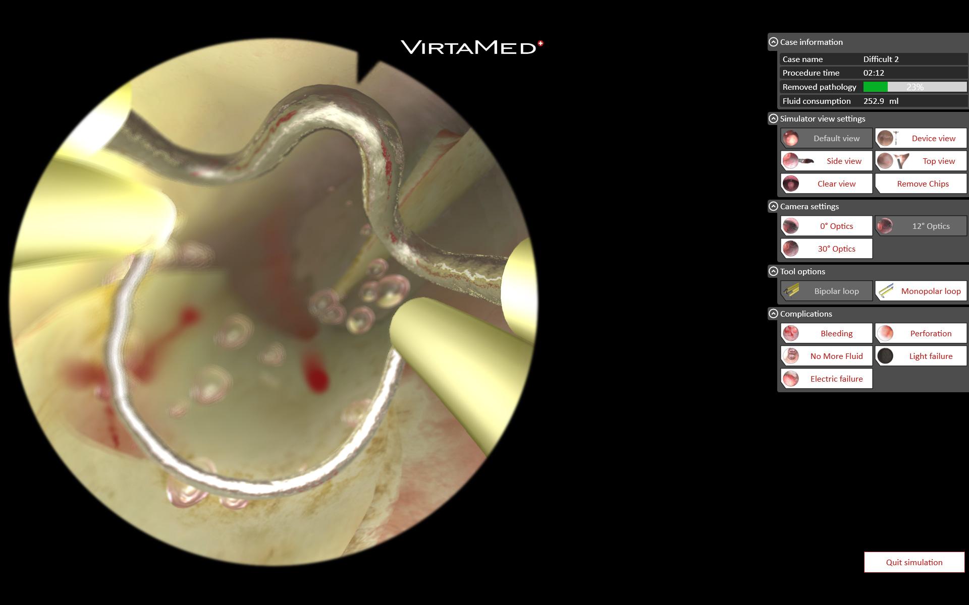 GynoS™ | Gynecology (OB/GYN) Training Simulator | VirtaMed