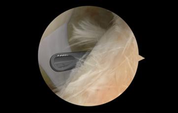 ArthroS™ | Realistic Arthroscopy Training Simulator | VirtaMed